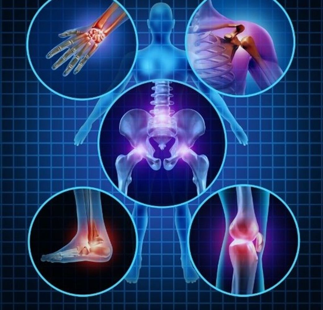 Arthritis | The Doctor's Kitchen